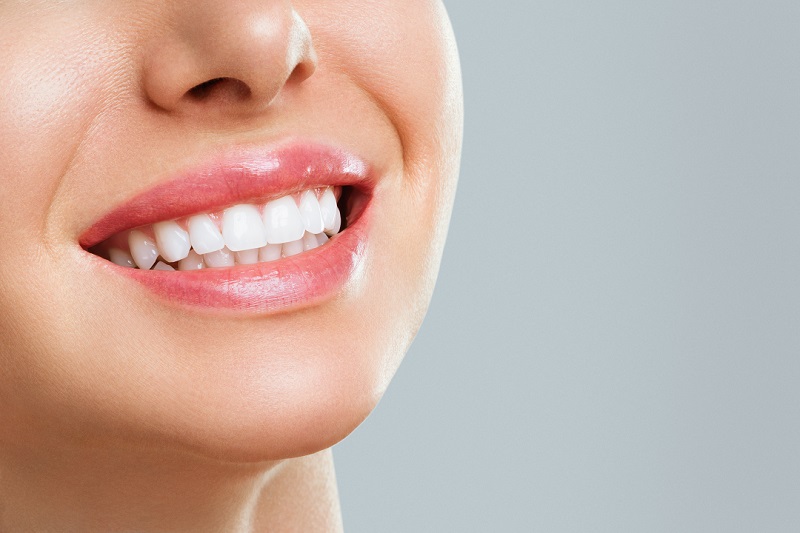 Carillas inyectadas: una opción para la sonrisa perfecta | SouriDent